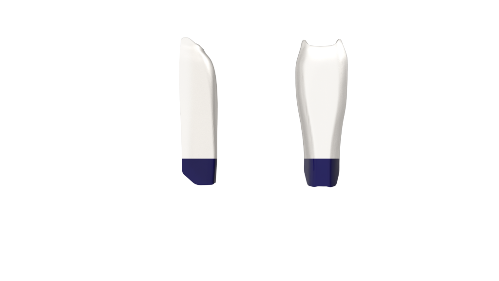 Black Triangle (BT) Kit - Bioclear