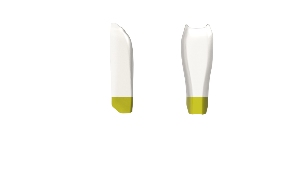 BT Matrix Series - Bioclear