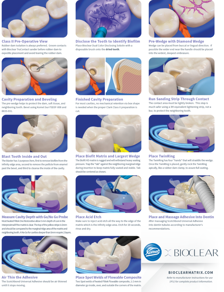 Illustrated Class II Procedural Guide - Bioclear