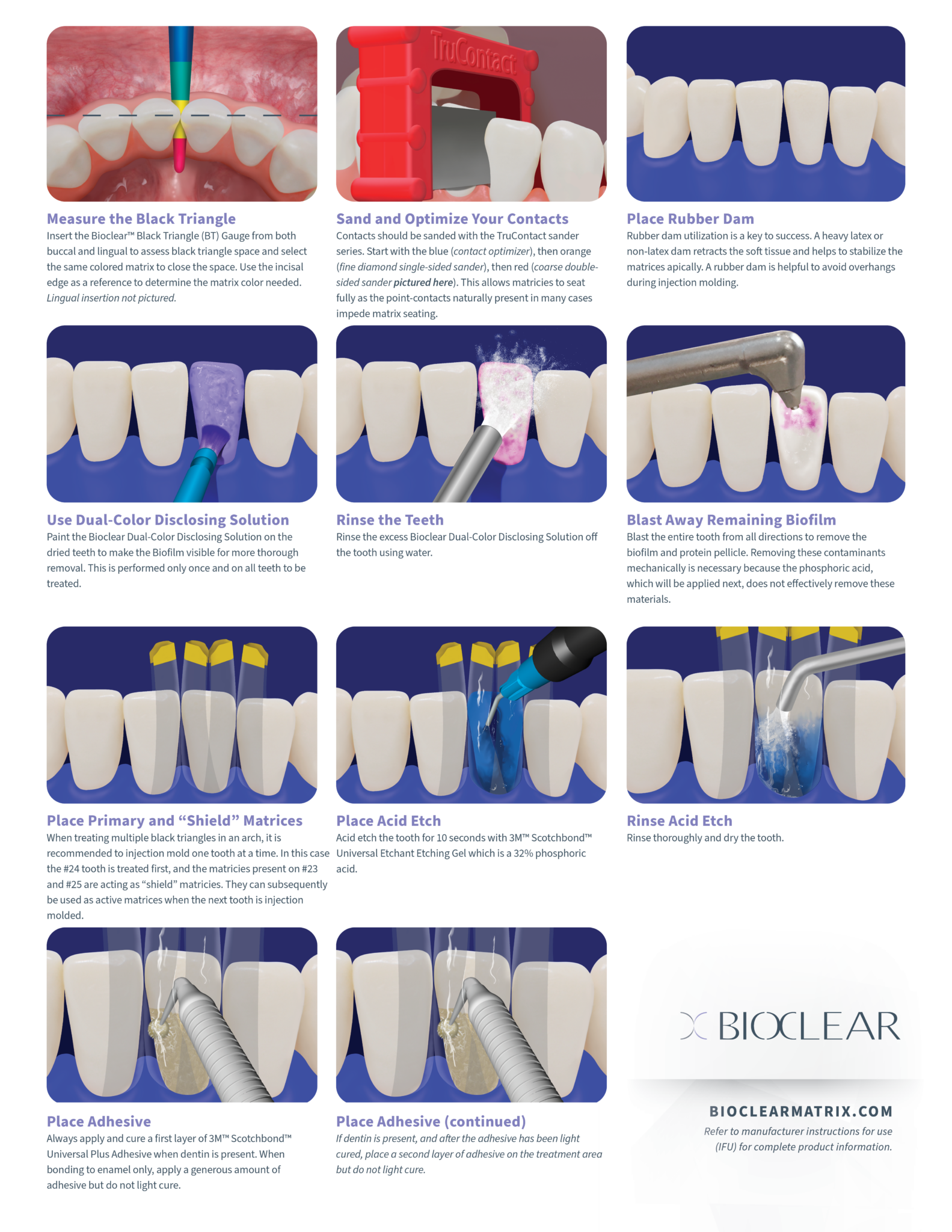 Illustrated Black Triangle Procedural Guide - Bioclear