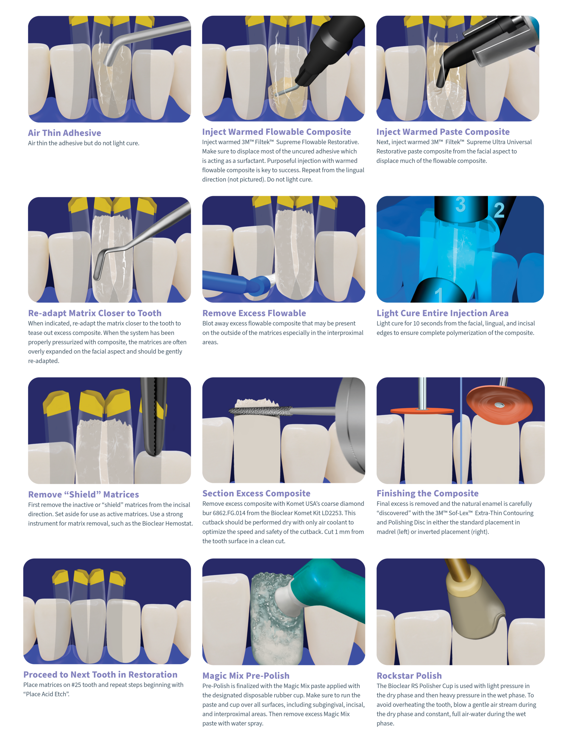 Illustrated Black Triangle Procedural Guide - Bioclear
