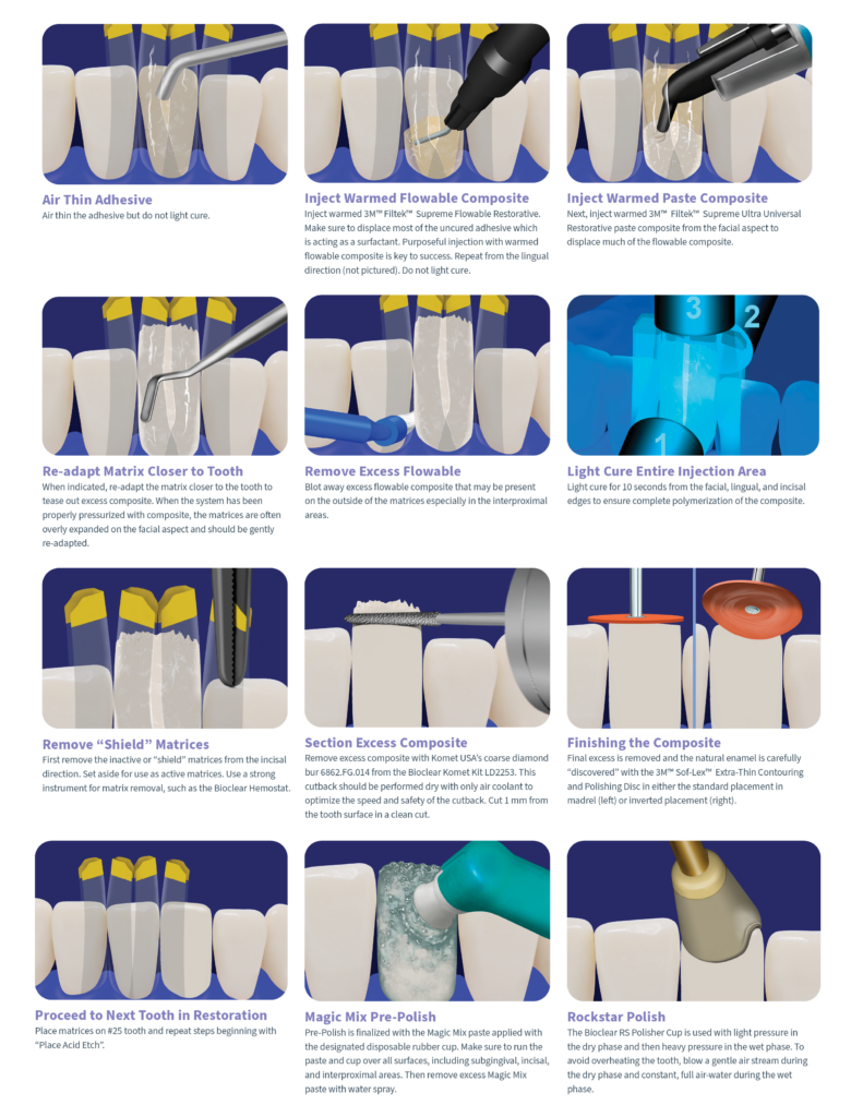 Illustrated Black Triangle Procedural Guide - Bioclear