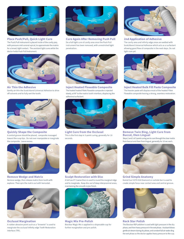 Bioclear Class II - Bioclear