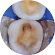 Learning Center - Bioclear
