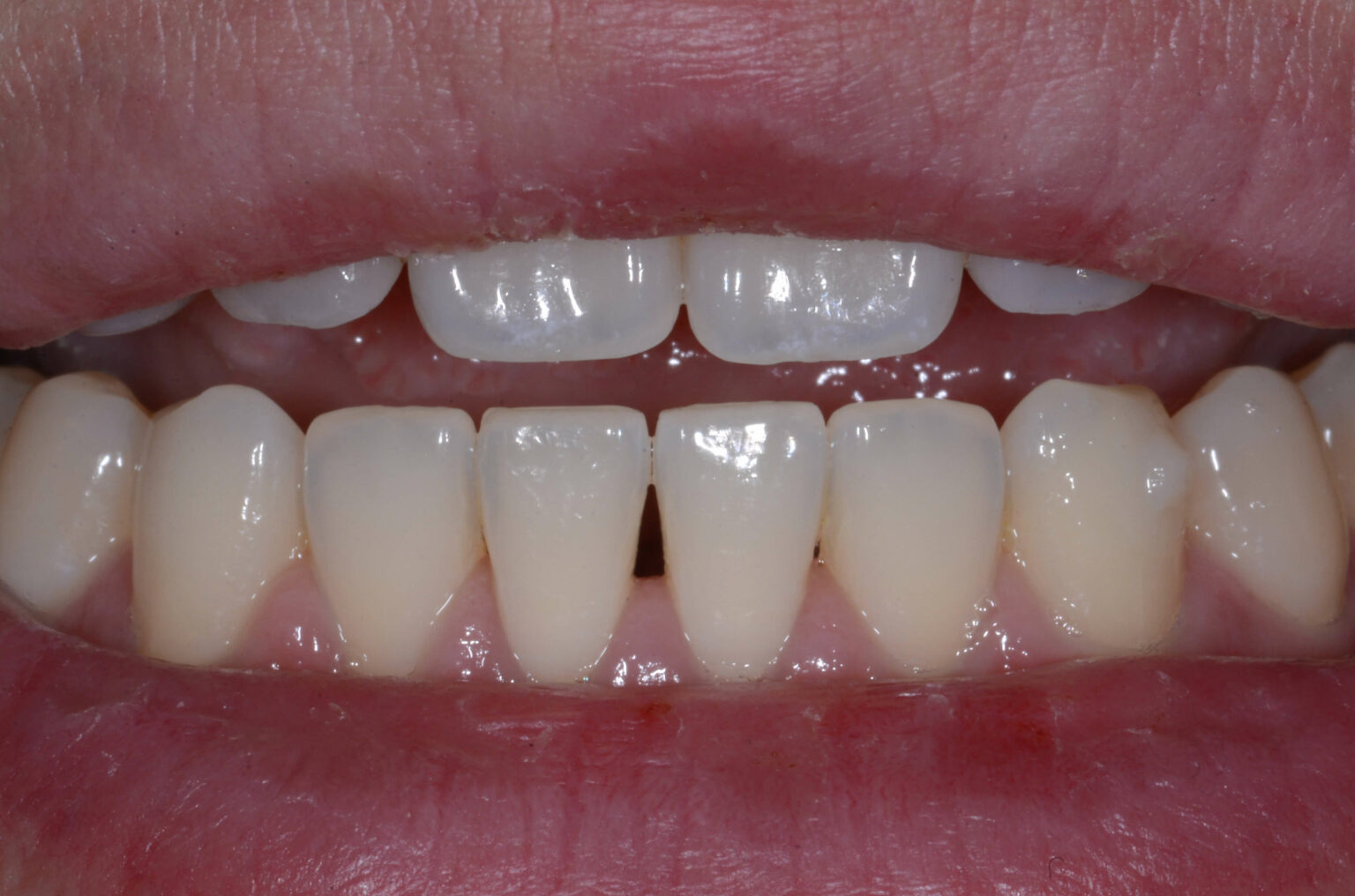 Mild to Wild by Dr. David Clark and Dr. Charles Regalado - Bioclear