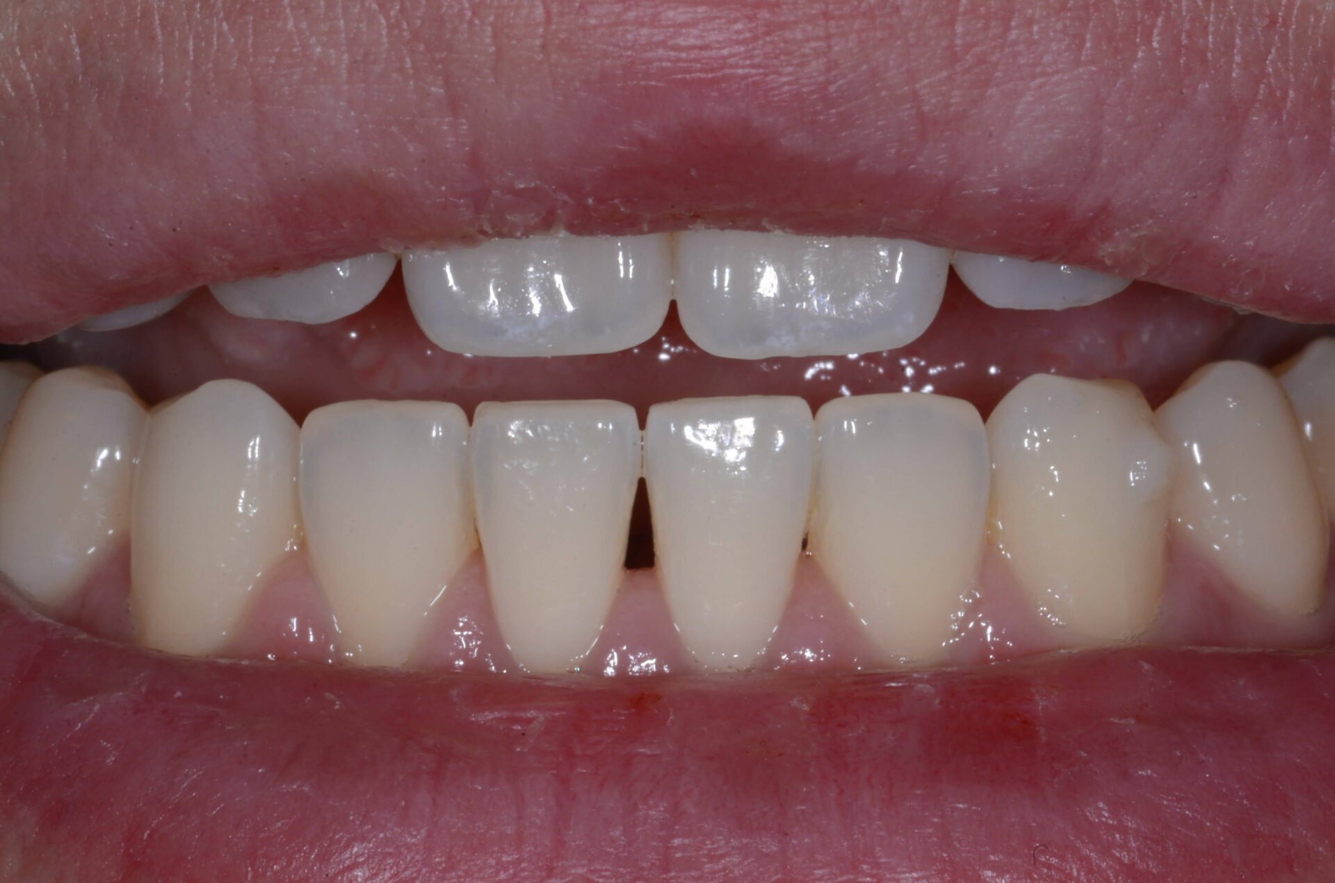 Mild to Wild by Dr. David Clark and Dr. Charles Regalado - Bioclear