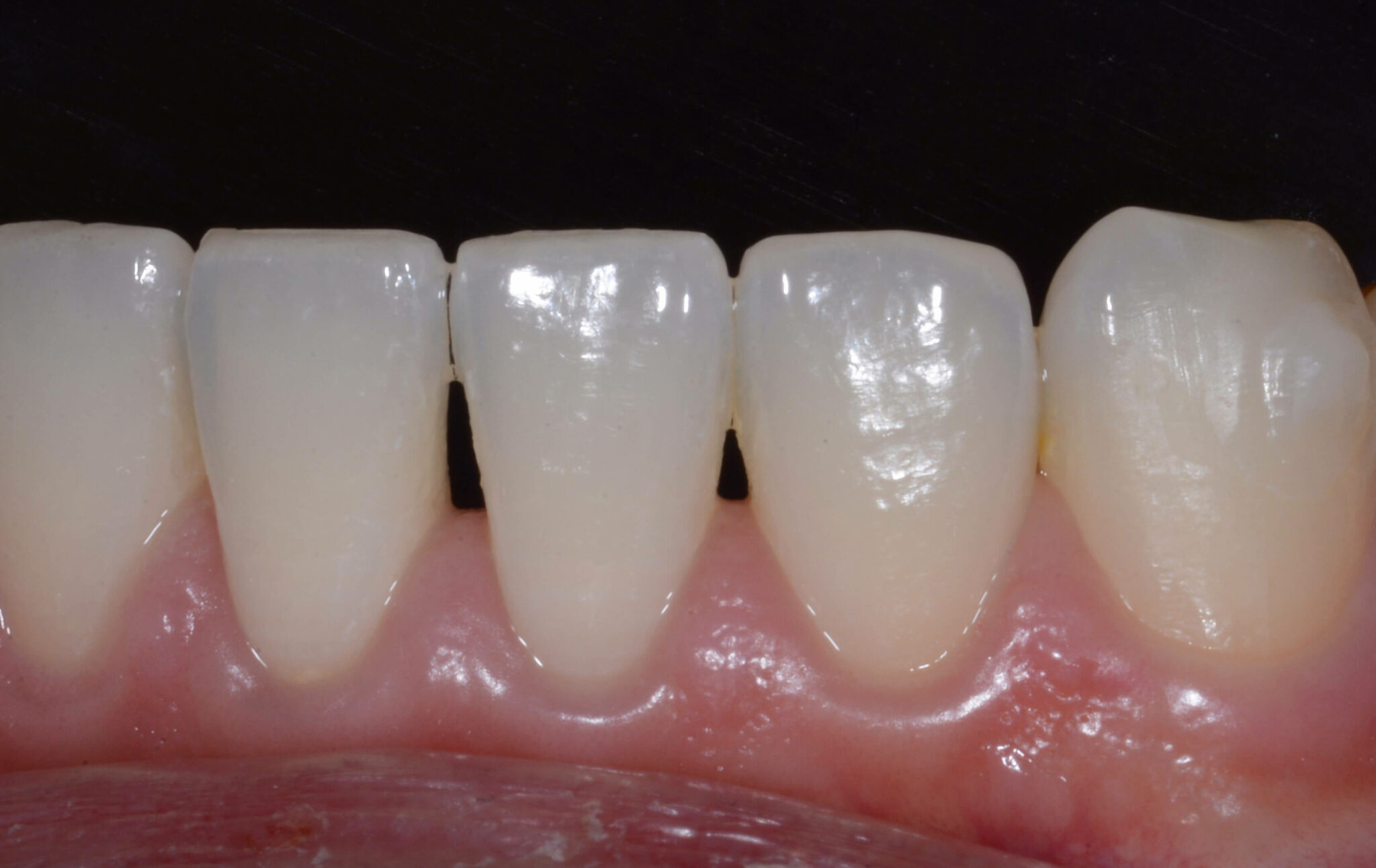 Mild to Wild by Dr. David Clark and Dr. Charles Regalado - Bioclear