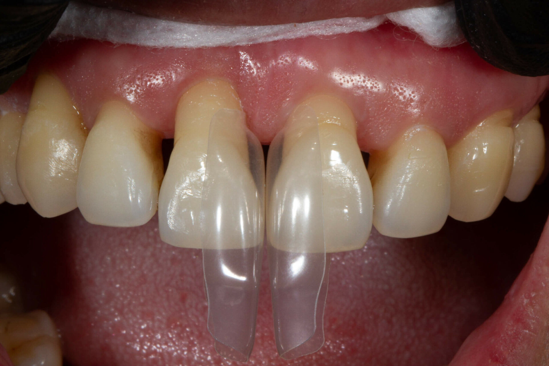 Mild to Wild by Dr. David Clark and Dr. Charles Regalado - Bioclear