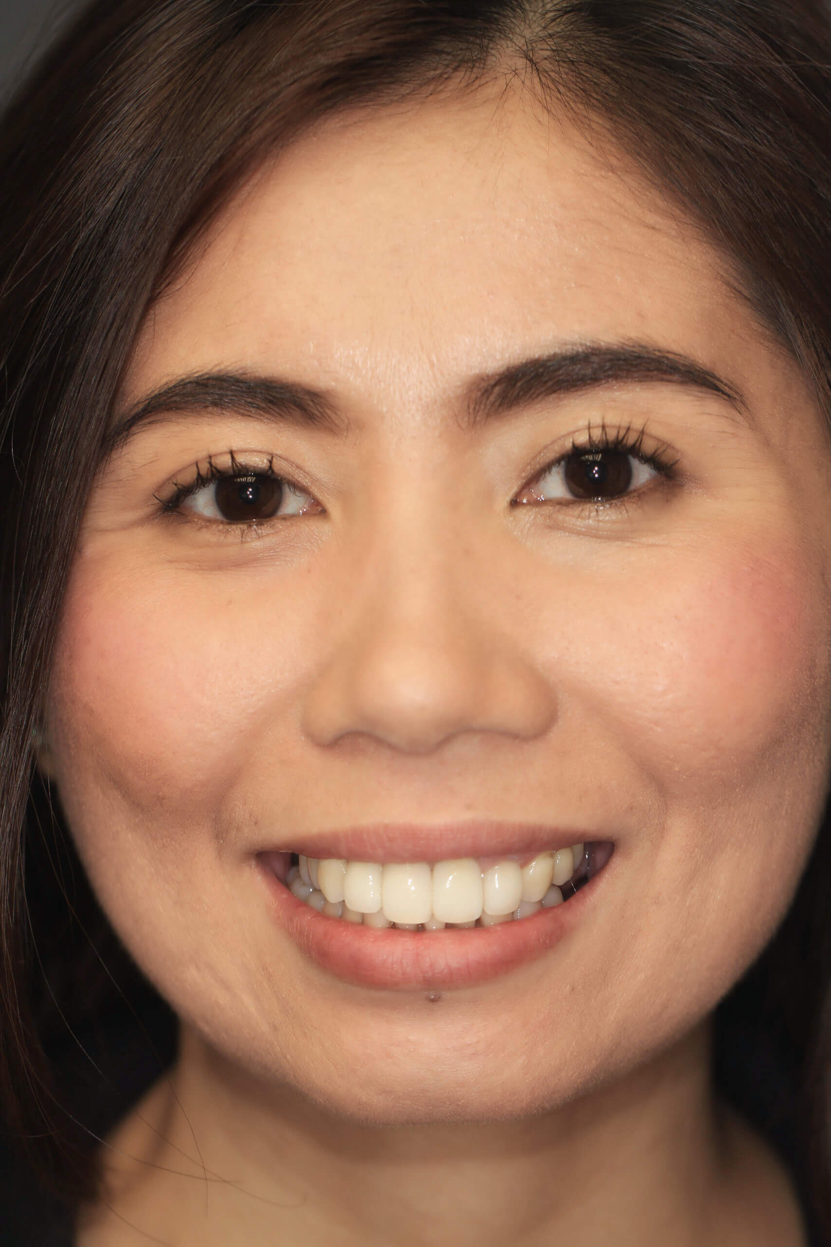 Mild to Wild by Dr. David Clark and Dr. Charles Regalado - Bioclear