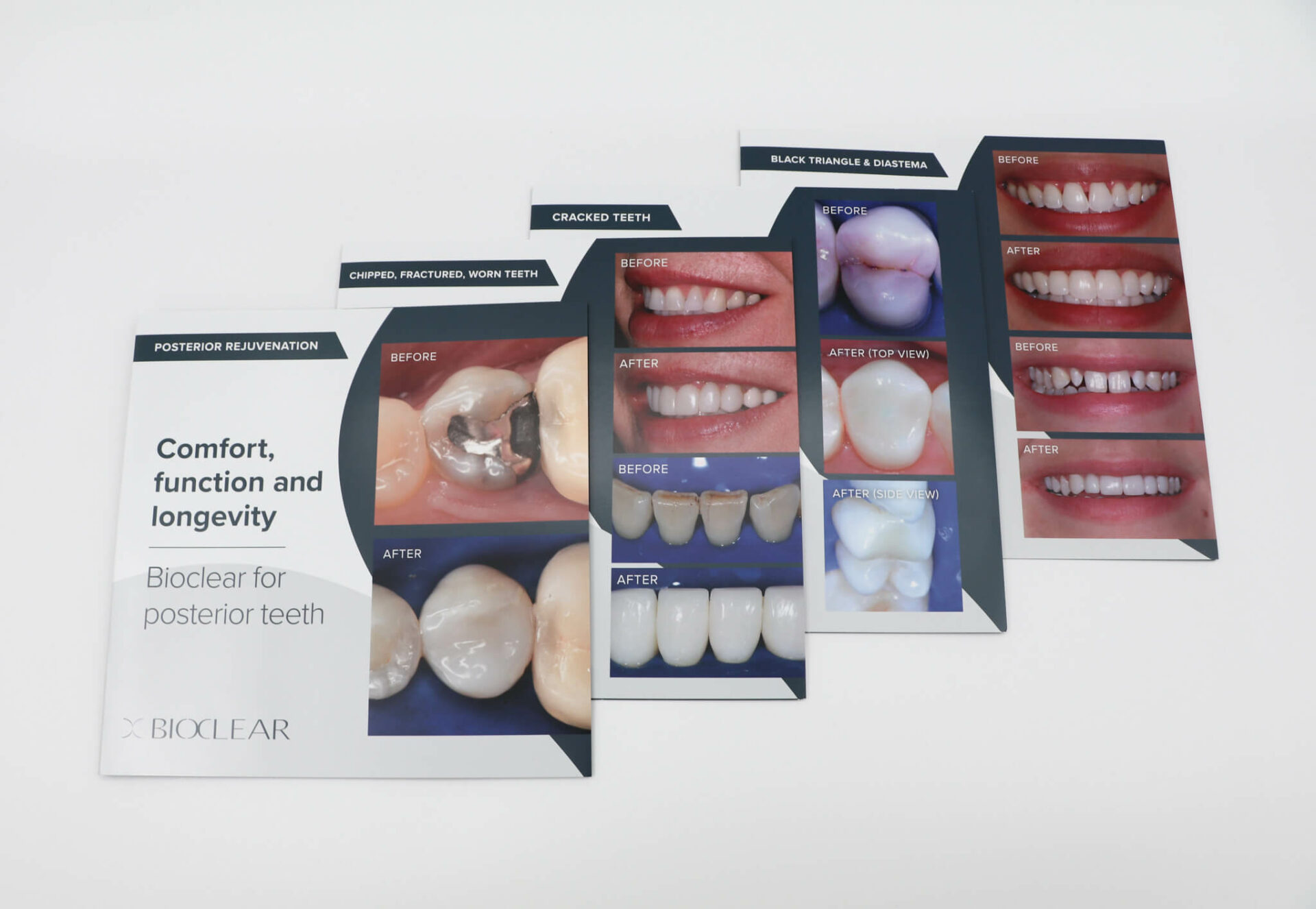 Patient Brochures - Bioclear