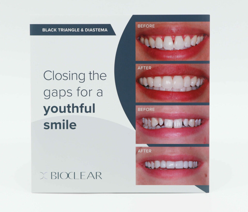 Patient Brochures - Bioclear