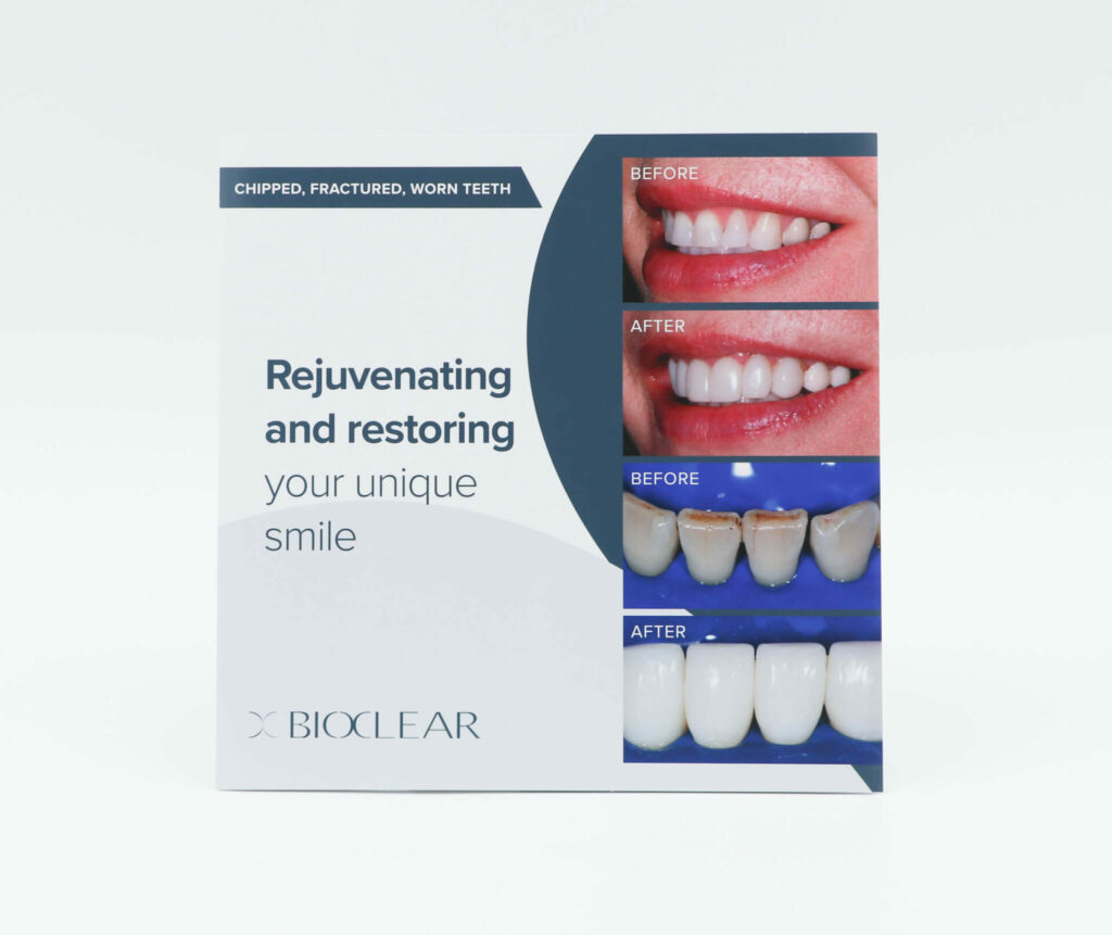 Patient Brochures - Bioclear