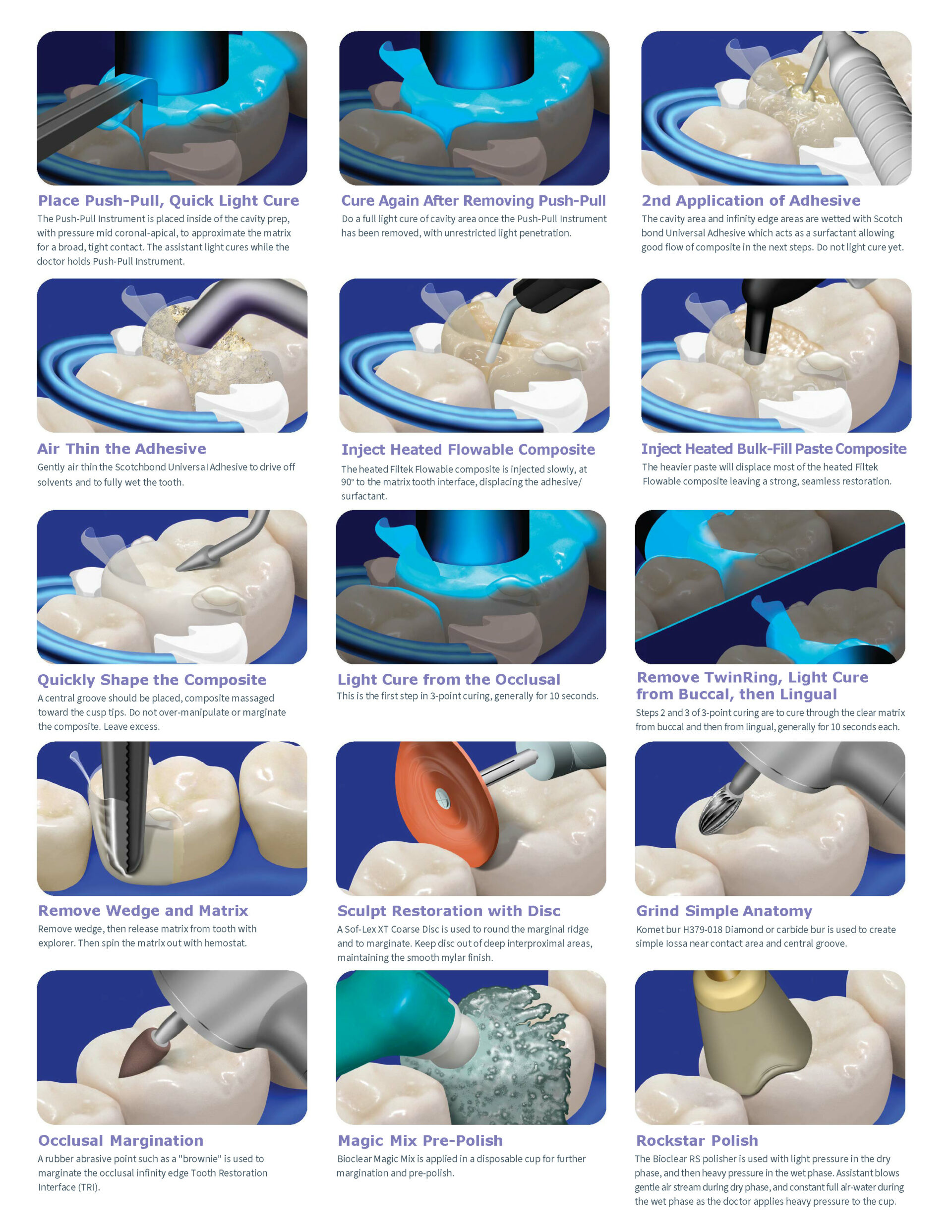 Illustrated Class II Procedural Guide - Bioclear