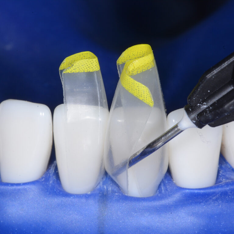 Learning Center - Bioclear