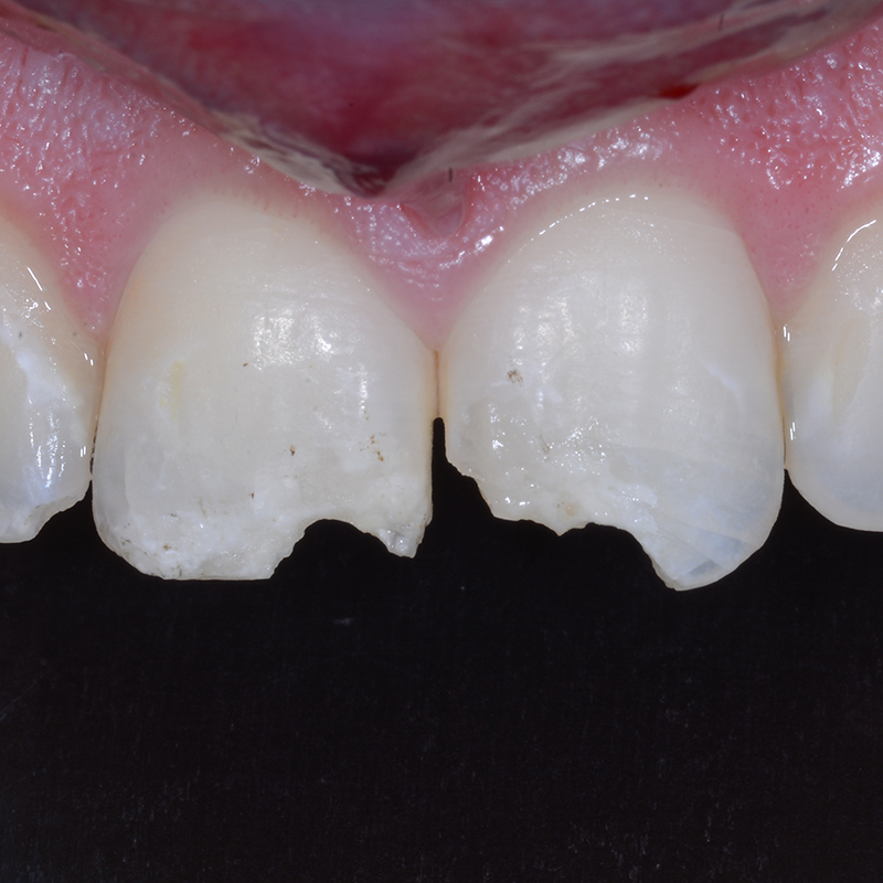 Learning Center - Bioclear